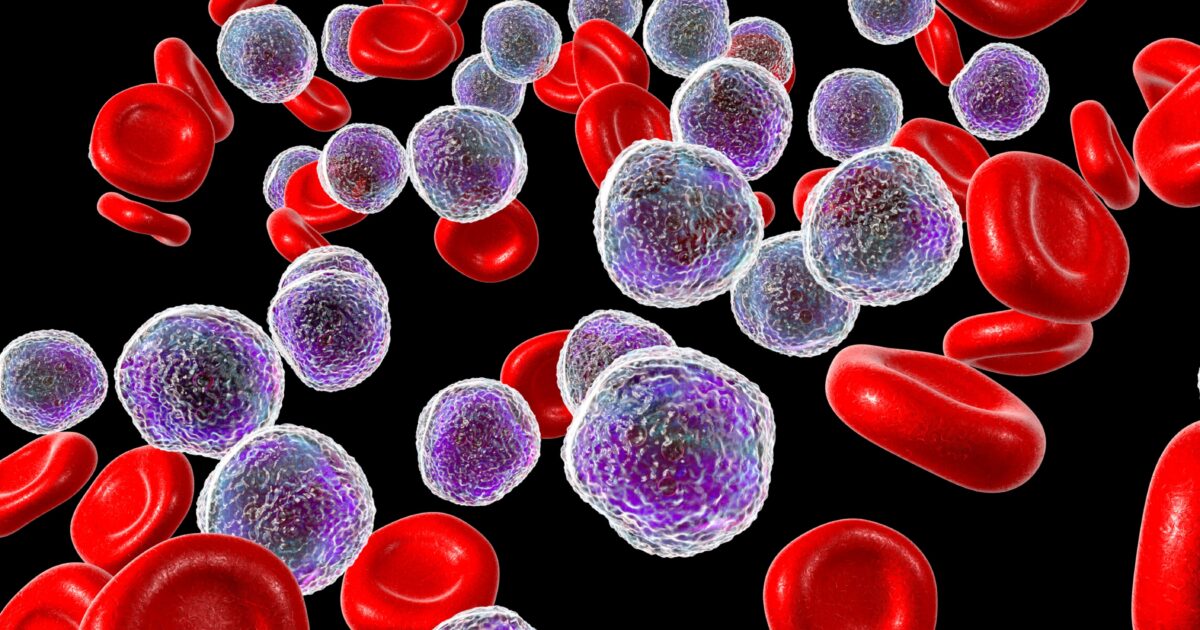 Genetic mutations and racial disparities in leukemia survival - Do No Harm